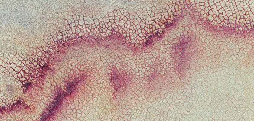 Why Do Cuts Bleed More On The Face And Scalp? – Health Prepper